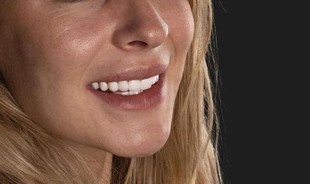 Smile Gallery – Miami, FL Dentist – Brickell Dental – General Dentist